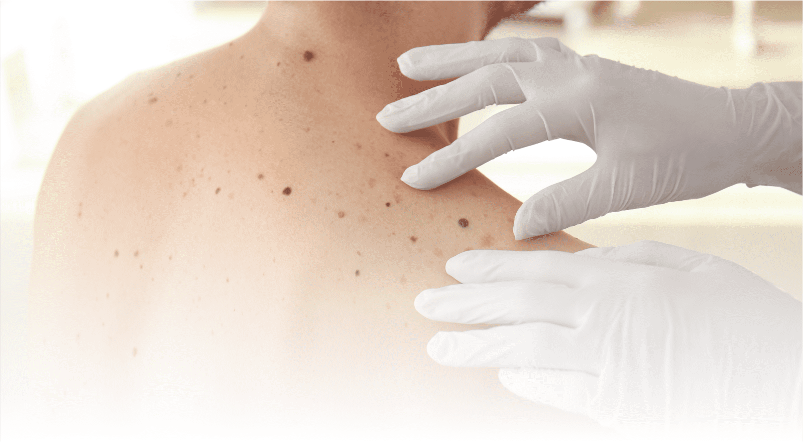 Skin Screening | SoCal Skin and Surgery